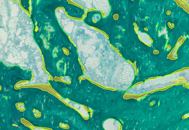 Bone Mineralization