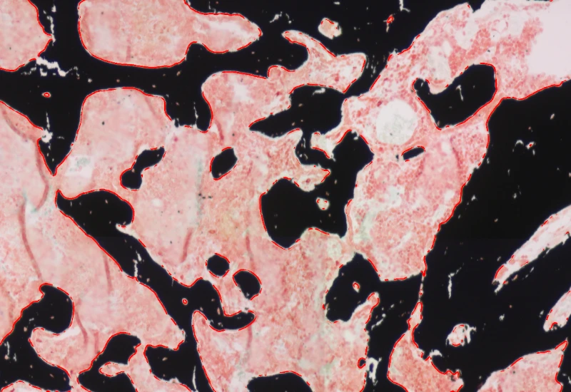 Bone Mineralization